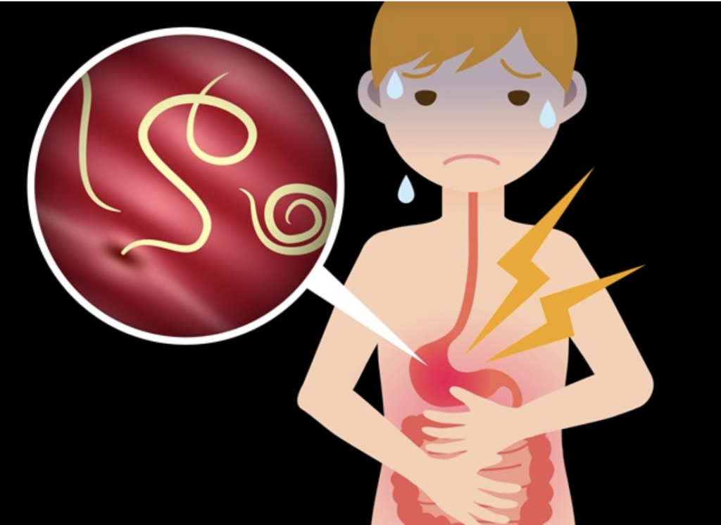 Worm infestation | CHAPTER 6 | Pediatric Nursing - Nursing & Midwifery ...