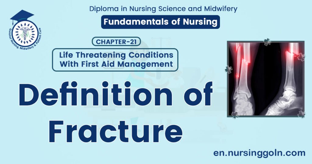 Definition of Fracture | CHAPTER 21 | Fundamentals of Nursing - Nursing ...