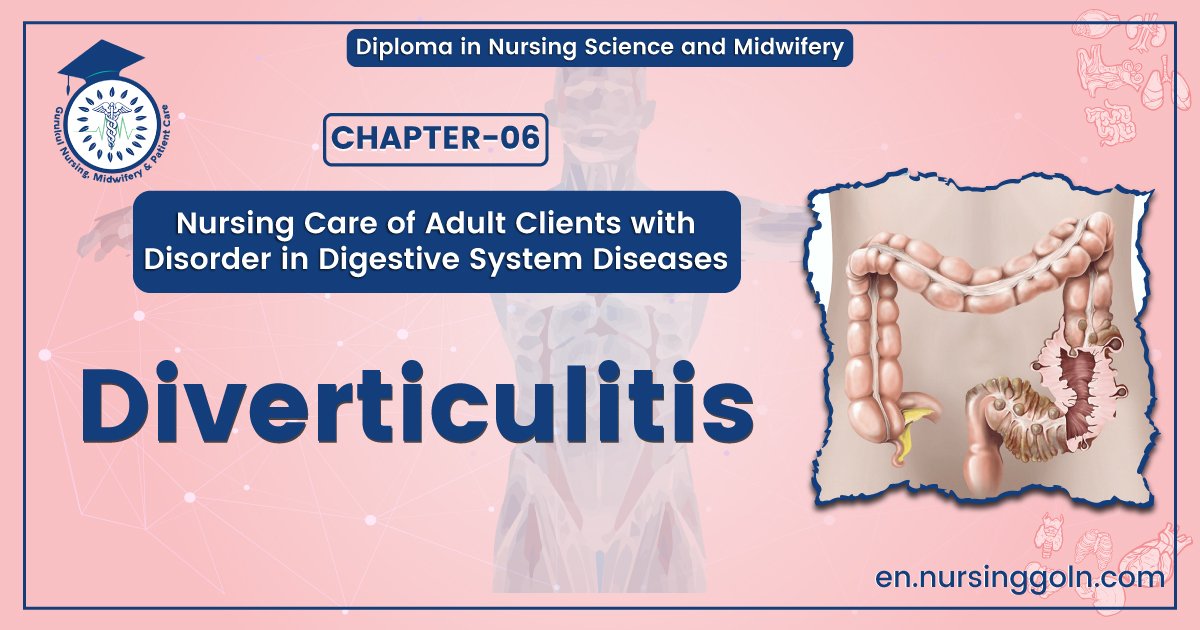 Definition of Diverticulitis | CHAPTER-6 | Medical and Surgical Nursing - Nursing & Midwifery ...