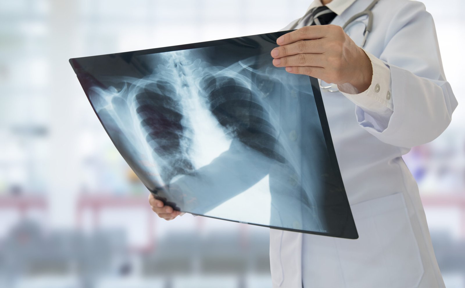 Definition of X Rays | CHAPTER 20 | Basic Science - Nursing & Midwifery ...