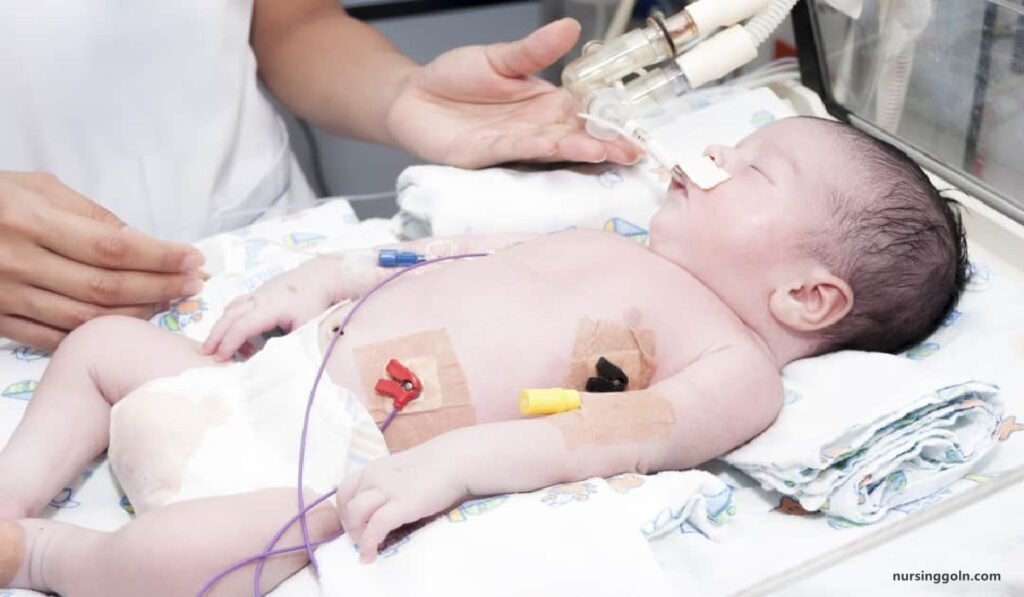 Common infections of neonate | CHAPTER 18 | Pediatric Nursing - Nursing ...