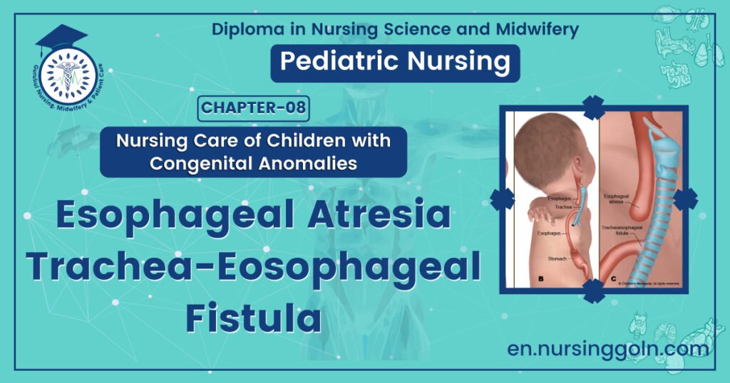 Esophageal Atresia/Trachea-Eosophageal Fistula | CHAPTER 8 | Pediatric ...