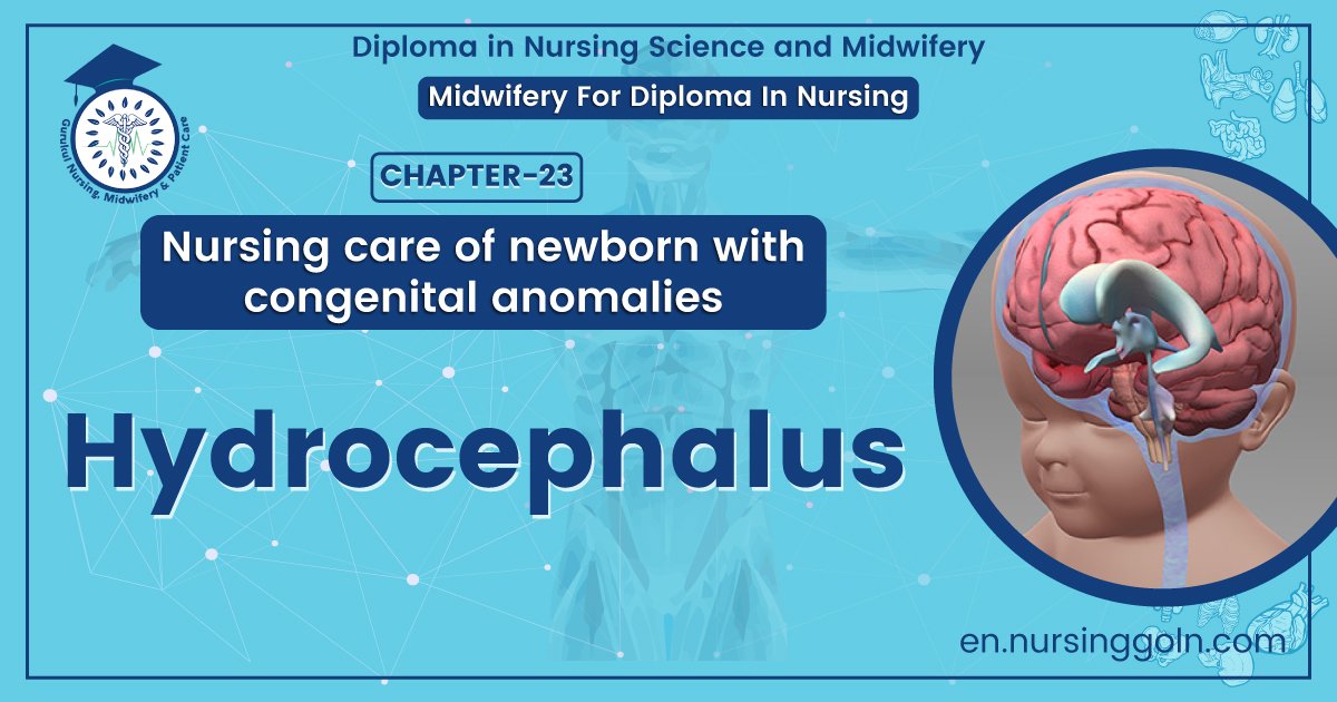 Classification of Hydrocephalus | Chapter 23 | Midwifery For Diploma In ...
