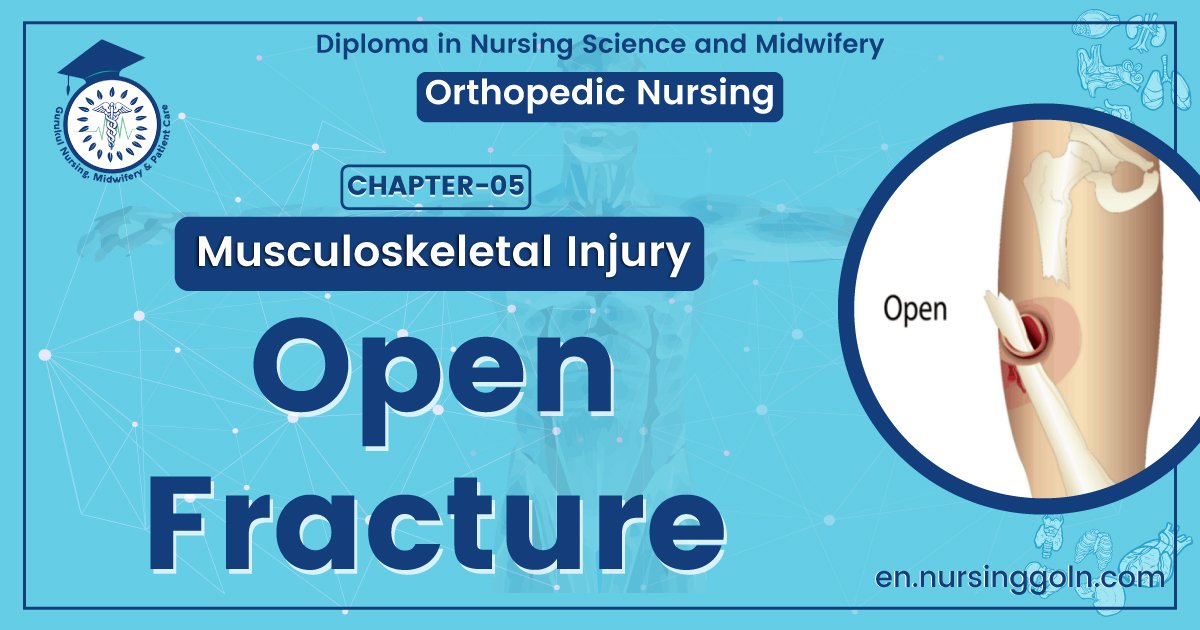 Open Fracture | CHAPTER 5 | Orthopedic Nursing - Nursing & Midwifery ...