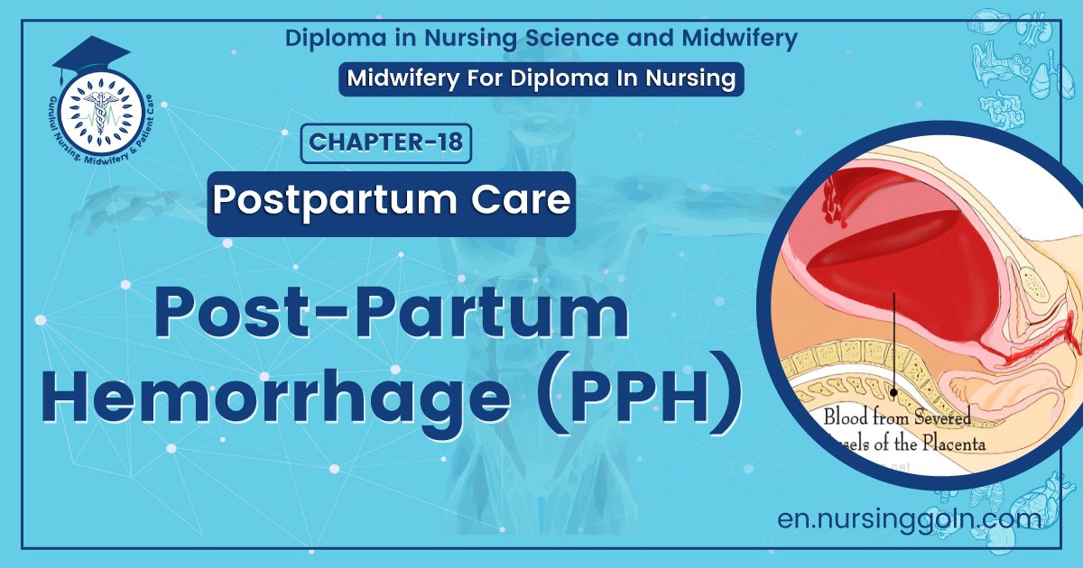 Post-Partum Hemorrhage (PPH) | Chapter 18 | Midwifery For Diploma In ...