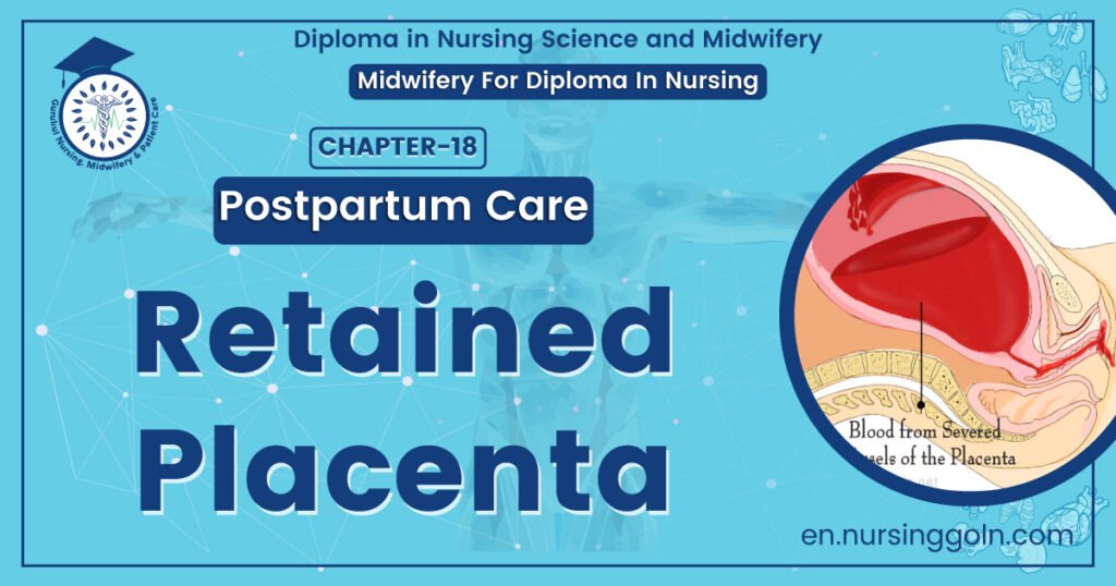 Retained Placenta | Chapter 18 | Midwifery For Diploma In Nursing ...